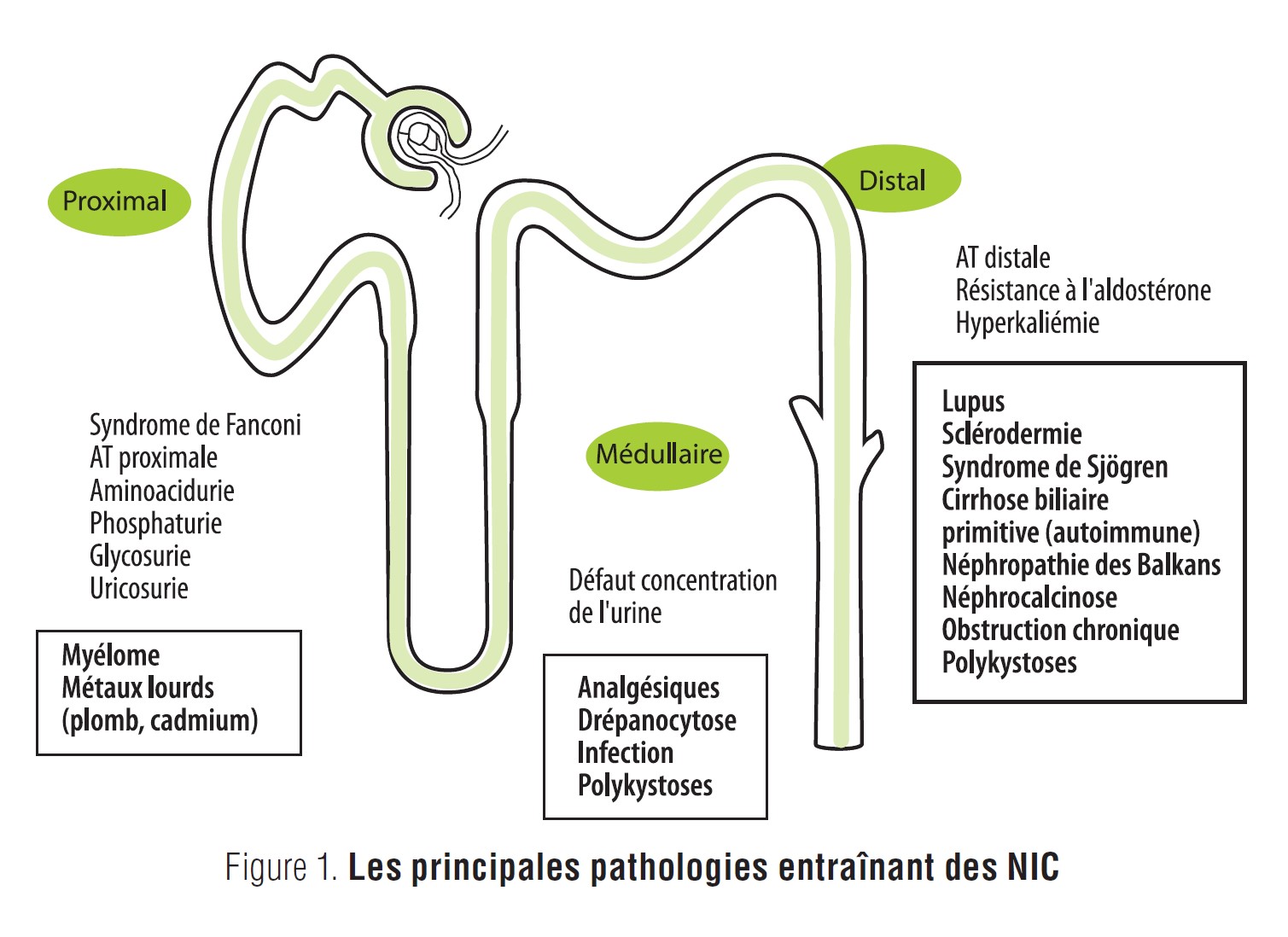 Chapitre 23 – Néphropathies interstitielles chroniques – Cuen Manuel